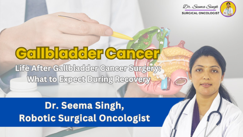 Life After Gallbladder Cancer Surgery: What to Expect During Recovery ...